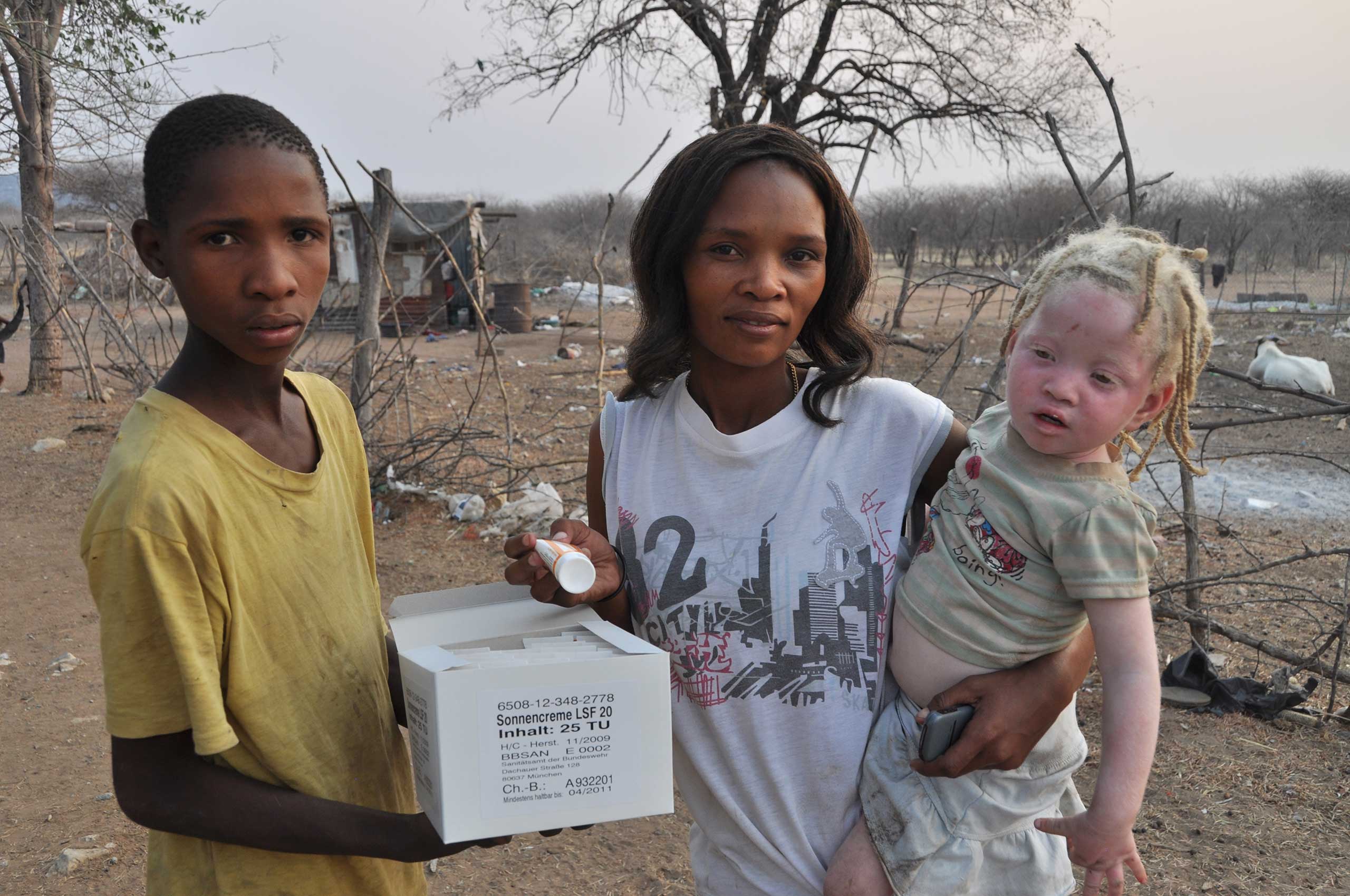Albinismus in Afrika - Support Ulm