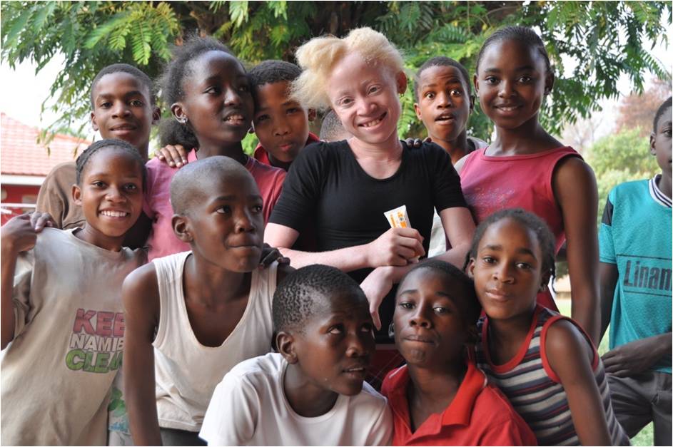 Alles Was Du Ber Albinismus Wissen Musst Demedbook